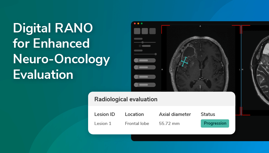 Digital RANO Assessment - Neuro Oncology